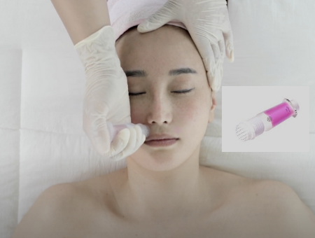 Pink Shooter – Huidtherapie Meijer